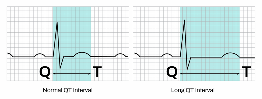 Cardiac function and structure: Insights for disease models and drug ...